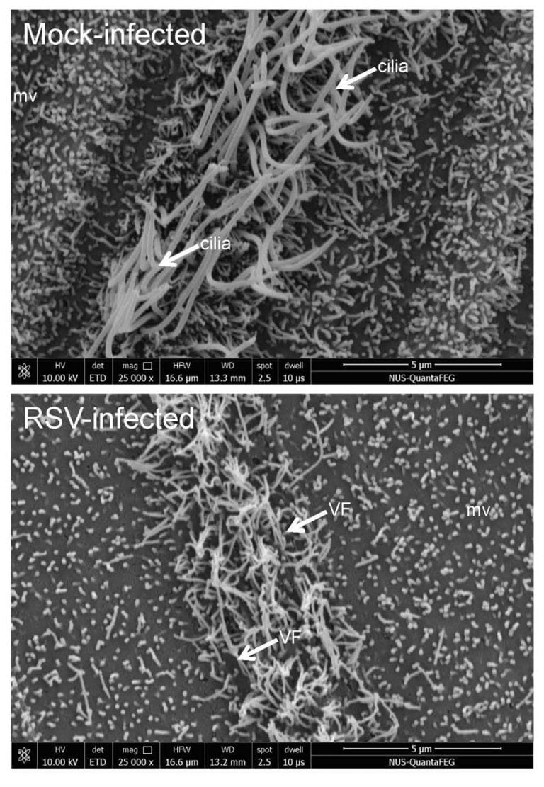 Zooming in on viruses | Research | NTU Singapore